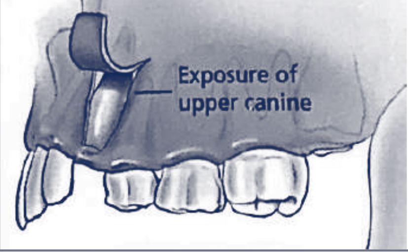 Dento-Alveolar Surgery - OMS Specialists