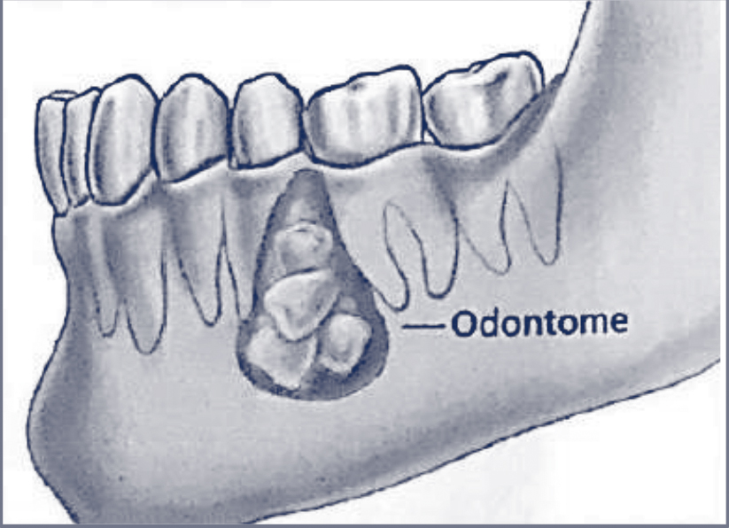 Dento-Alveolar Surgery - OMS Specialists